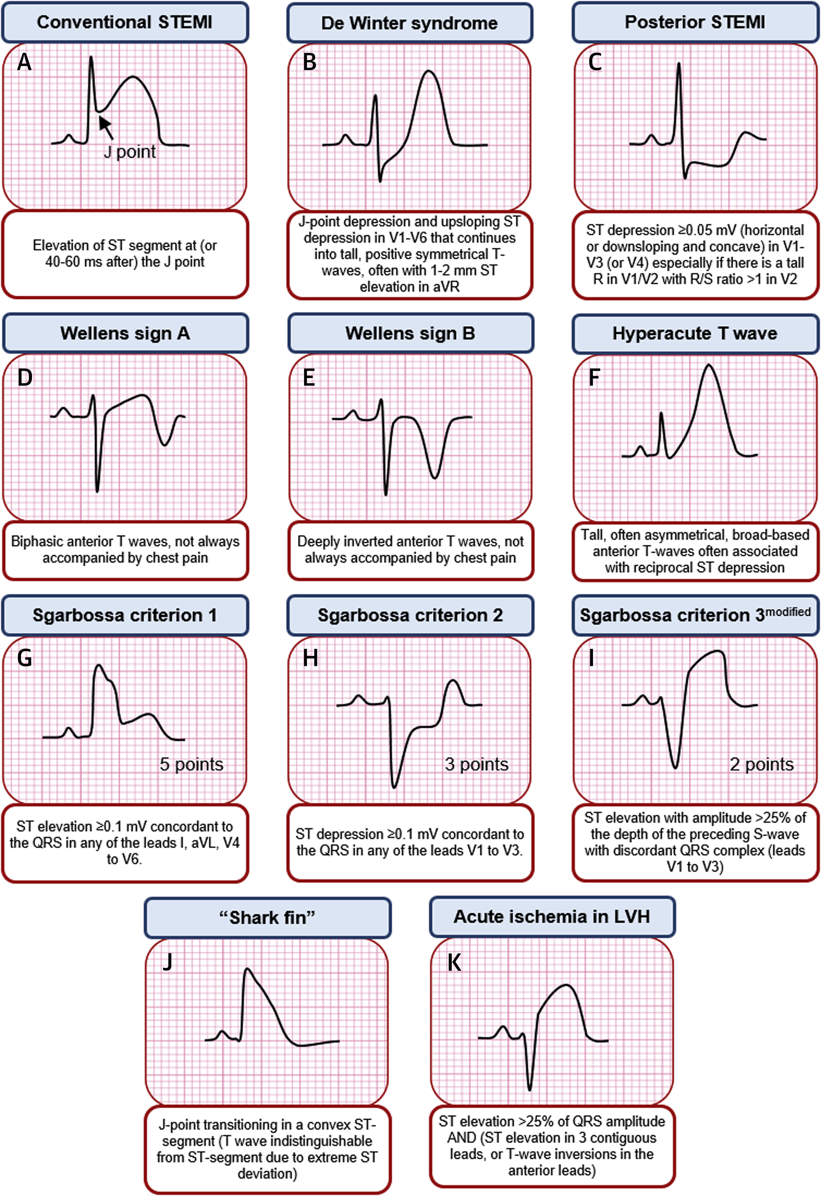 Credit: J Am Coll Cardiol Case Rep. 2019 Dec, 1 (4) 666-668.